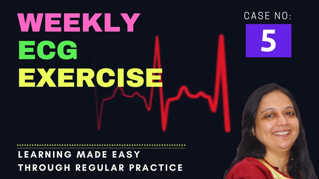 Weekly ECG Exercise: case 5 - YouTube