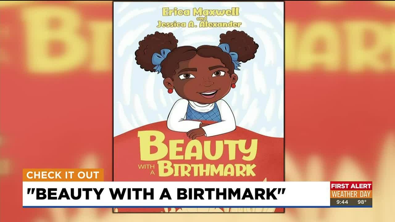 Kids' book "Beauty with a Birthmark" authors visit Good Morning ...