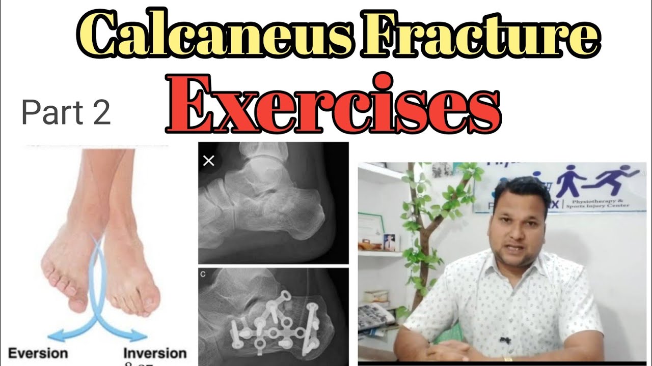 Calcaneus Fracture Recovery Exercises | calcaneus Fracture ...