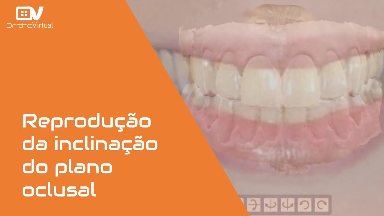 Reprodução da inclinação do plano oclusal - YouTube