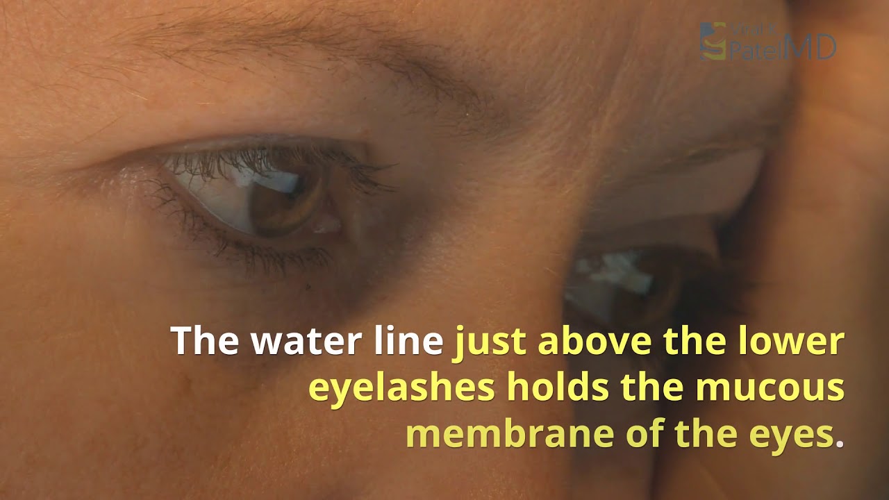 Can you tell from your eyes if you are anemic? | Viral Patel MD ...