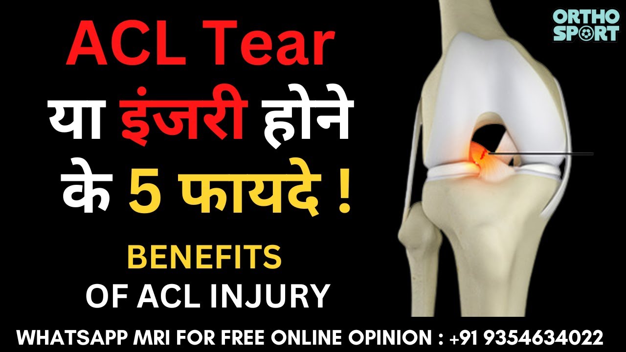 ACL Tear या इंजरी होने के 5 फायदे ! 5 Benefits of ACL Tear - YouTube