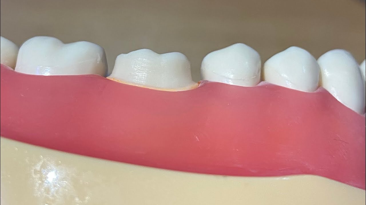 Students’ work in preclinical practice of Conservative Dentistry (3rd ...