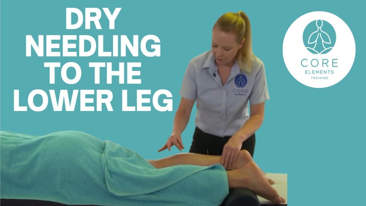 Dry Needling to the lower leg - YouTube