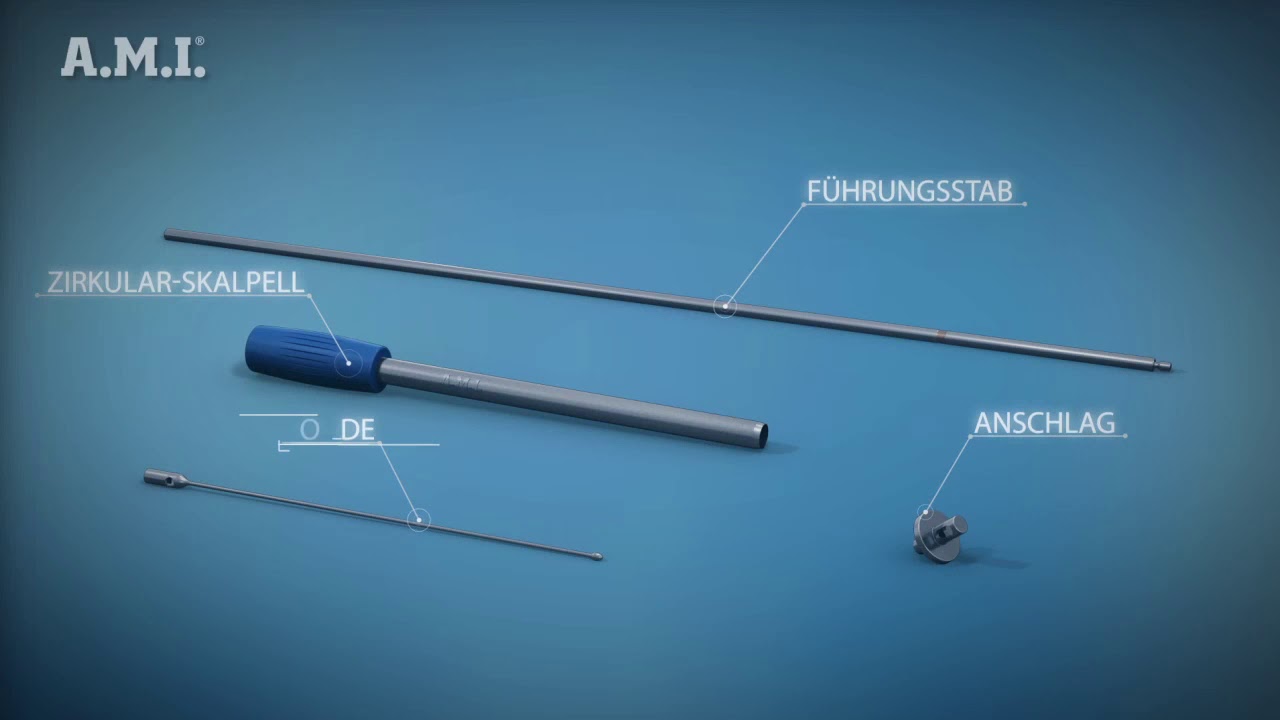 Präzise Exzision von Analfisteln - FiXcision von A.M.I.- 3D ...