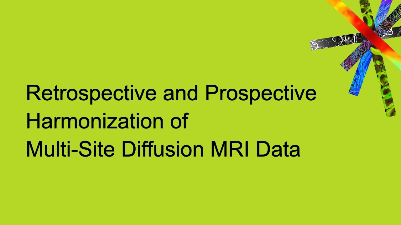 Retrospective and Prospective Harmonization of Multi-Site Diffusion MRI ...