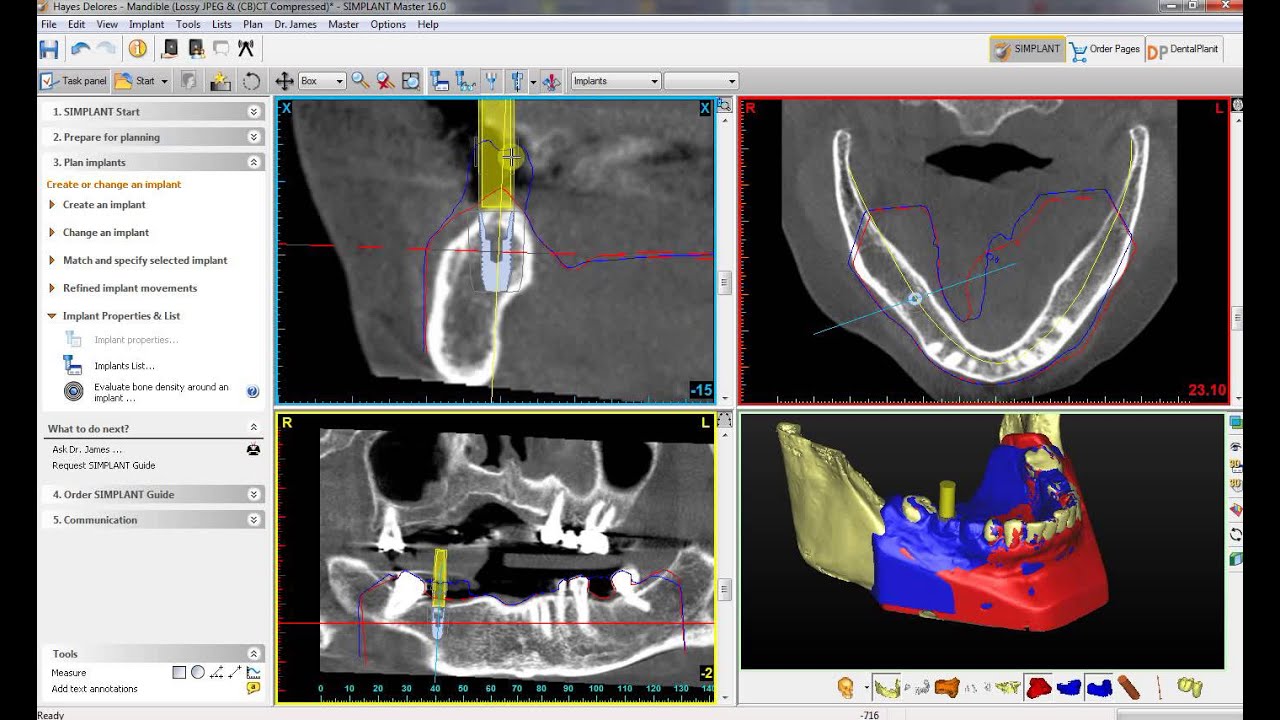 4. How to use the guide tubes function - YouTube