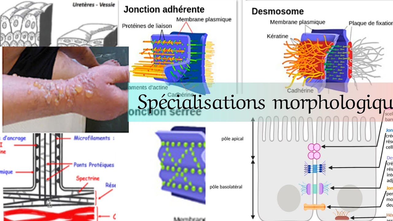 Spécialisations morphologique de la membrane plasmique - YouTube