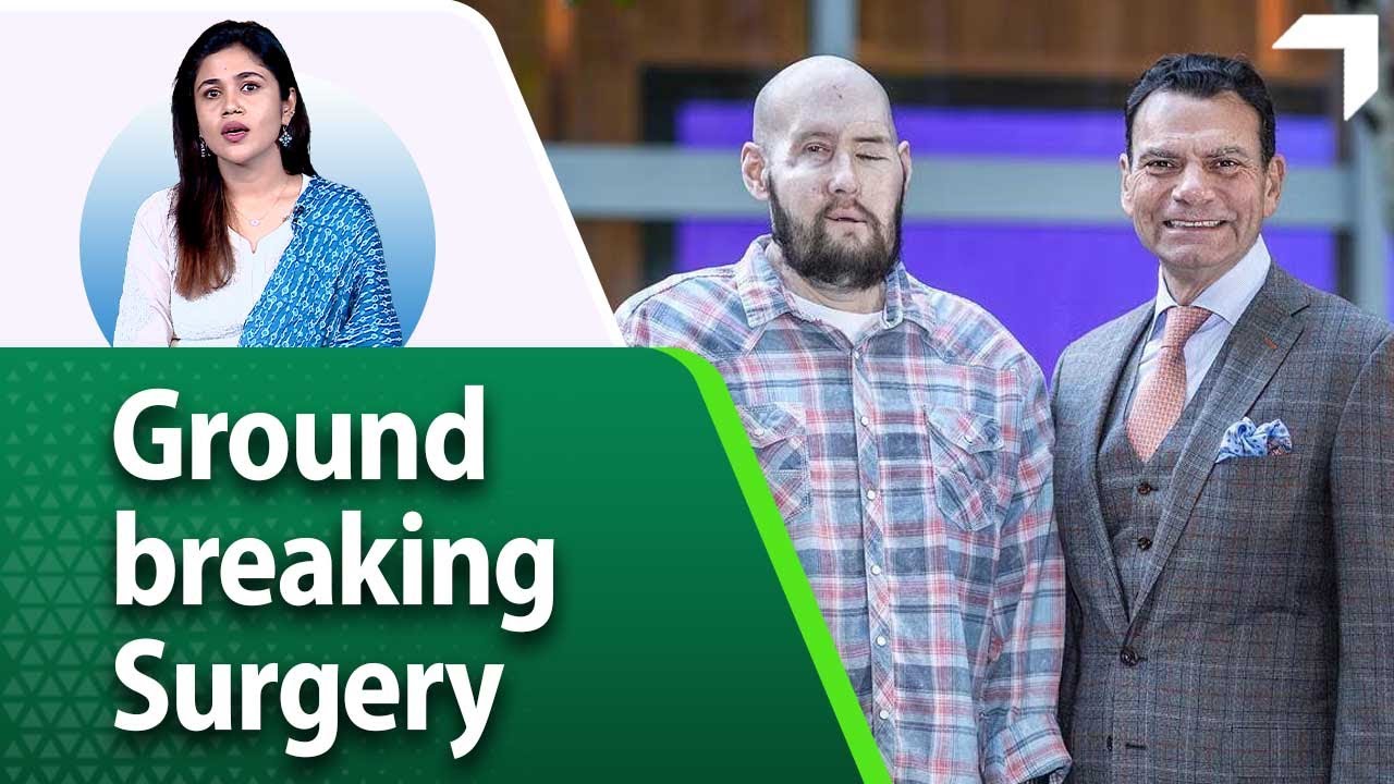 Doctors Complete First Successful Face and Whole - Eye Transplant - YouTube