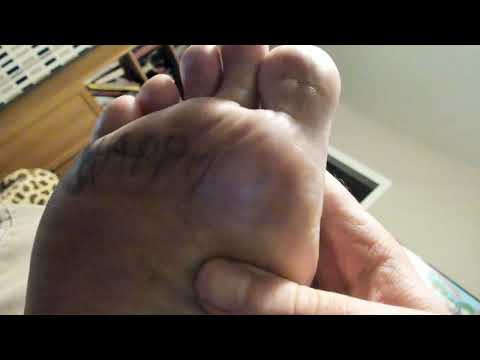 My Feet Soles and Toes 1/1/2024