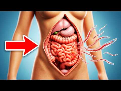 Natural Parasite Cleanse: What to Eat to Eliminate Intestinal Worms