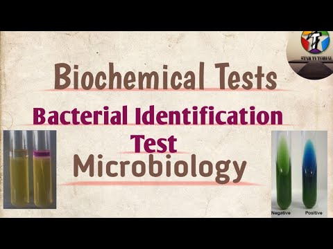 Biochemical Tests ll Bacterial Identification test ll Microbiology ...