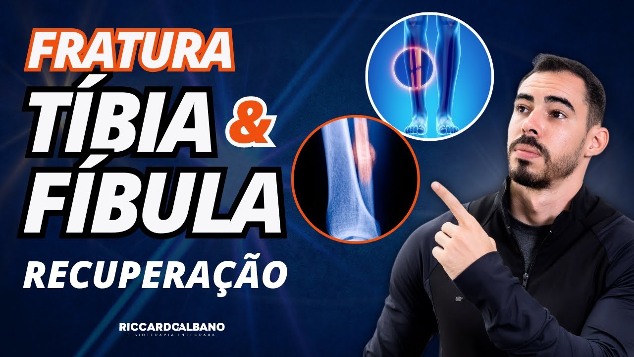 Recuperação de Fratura de TÍBIA e FÍBULA - YouTube