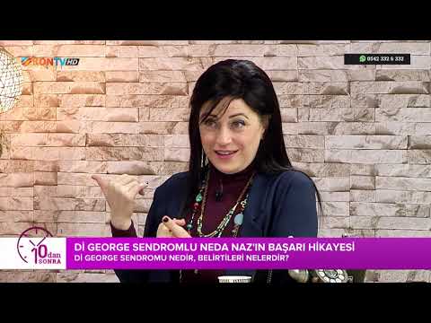 10DAN SONRA - Dİ GEORGE SENDROMLU NEDA NAZIN BAŞARI HİKAYESİ - 21 ARALIK 2020