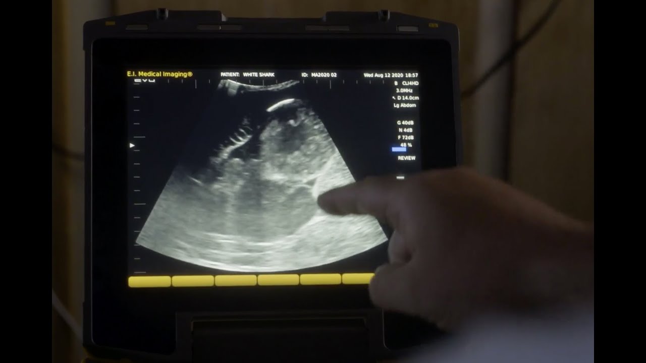 SCIENCE BRIEF: White Shark Ultrasounds - YouTube