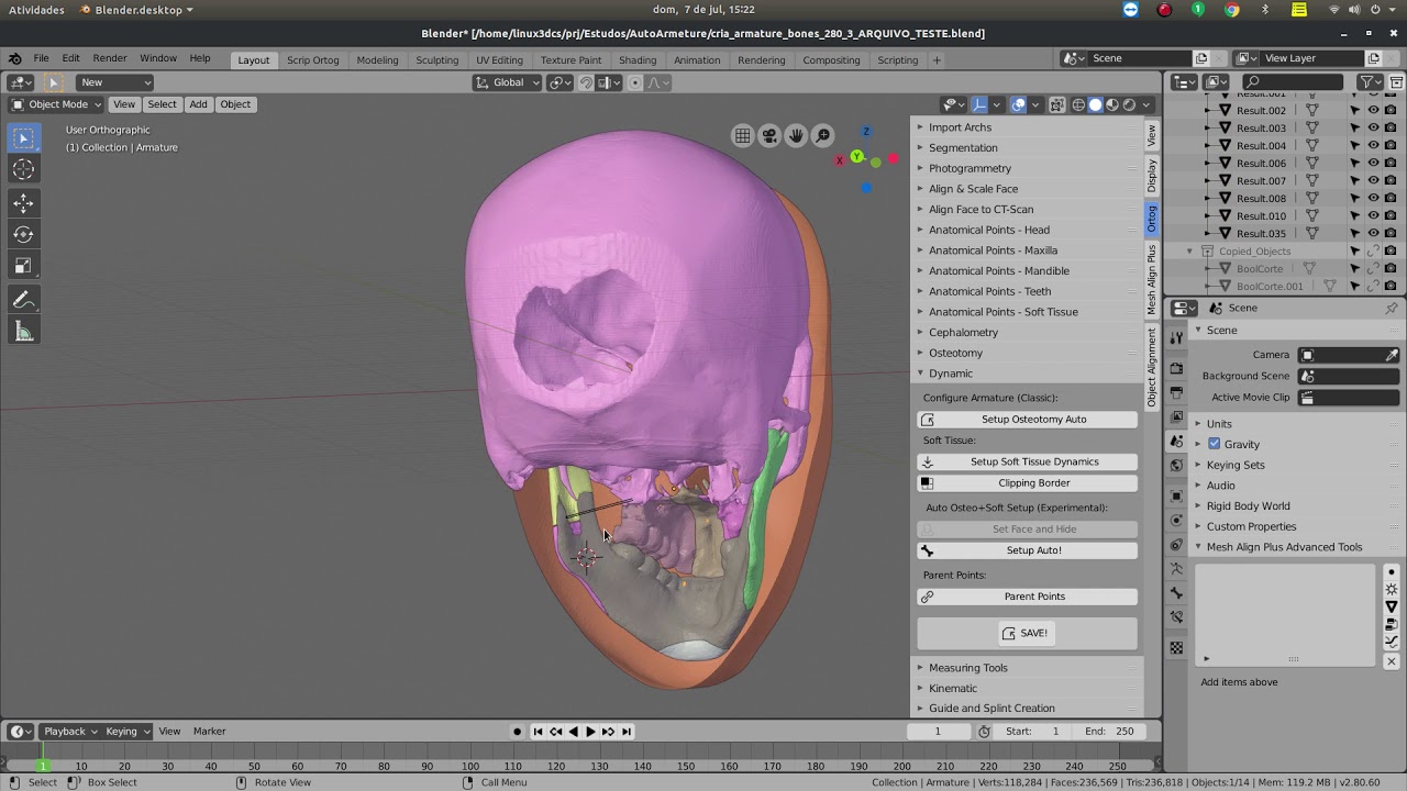 OrtogOnBlender - Multi osteo + soft auto! - YouTube