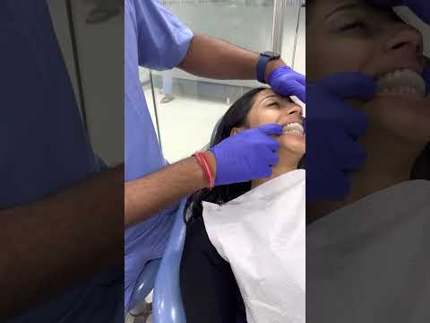 TMJ splint to relive pain in patients with chronic Jaw joint pain - YouTube