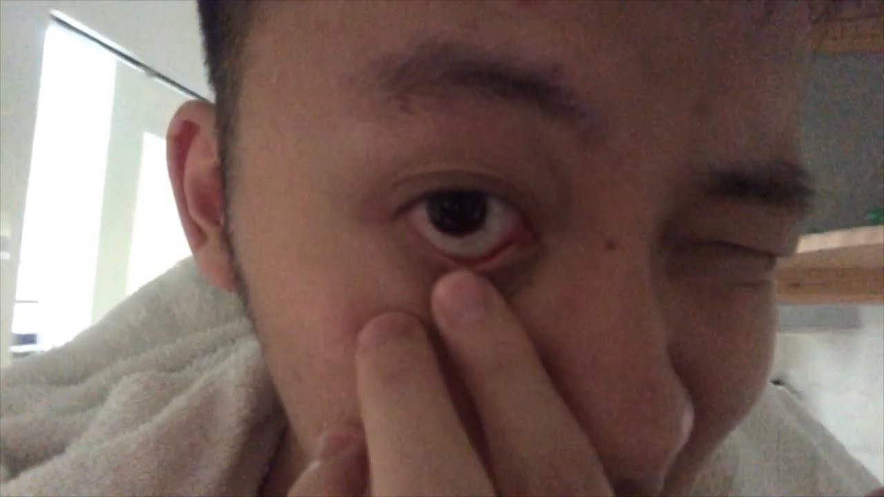 Something Got Into My Eye And I Didn t Go To My First Lecture Of The something-got-into-my-eye-and-i-didn-t-go-to-my-first-lecture-of-the