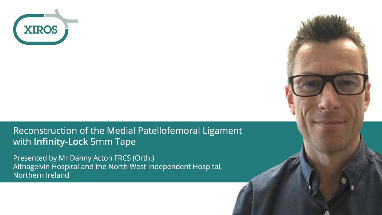 Reconstruction of the Medial Patellofemoral Ligament with Infinity-Lock ...
