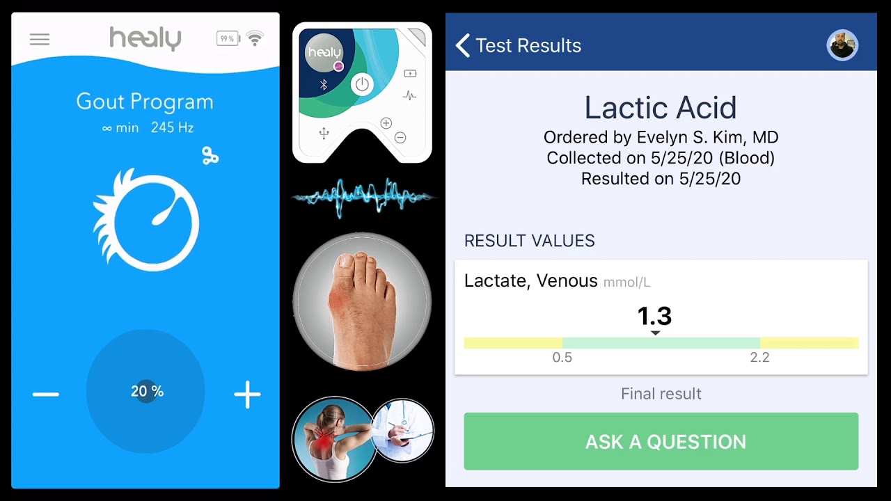 Frequency technology and gout - YouTube