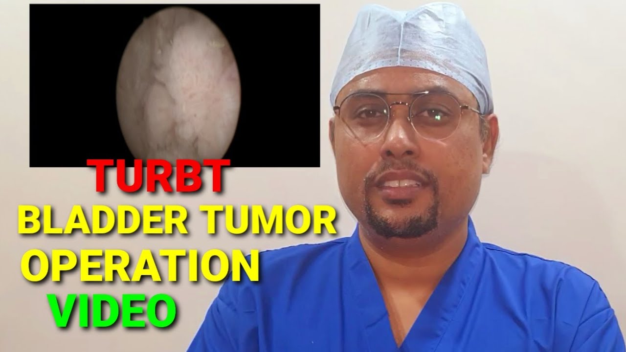 TURBT Transurethral Resection Of Bladder Tumor 