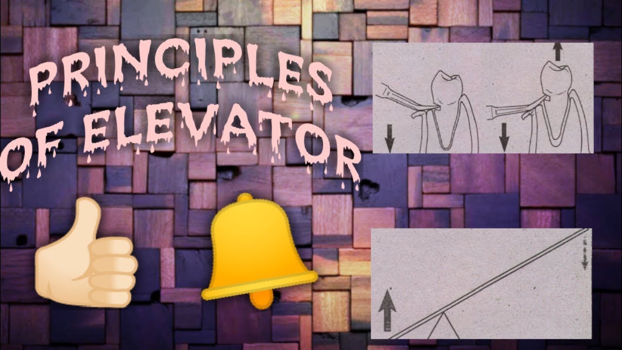 MECHANICAL WORK PRINCIPLES OF ELEVATORS AND FORCEPS| Learning made easy ...