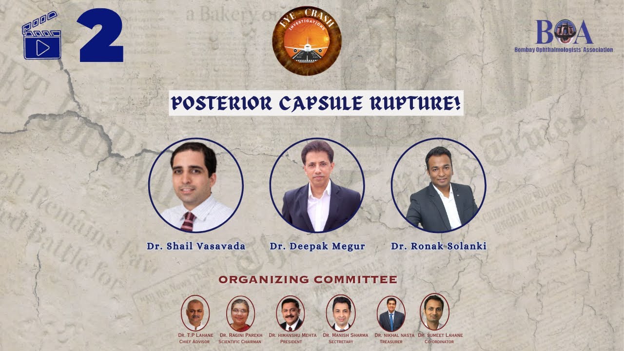 Eye Crash Investigations on Posterior Capsular Rupture. - YouTube
