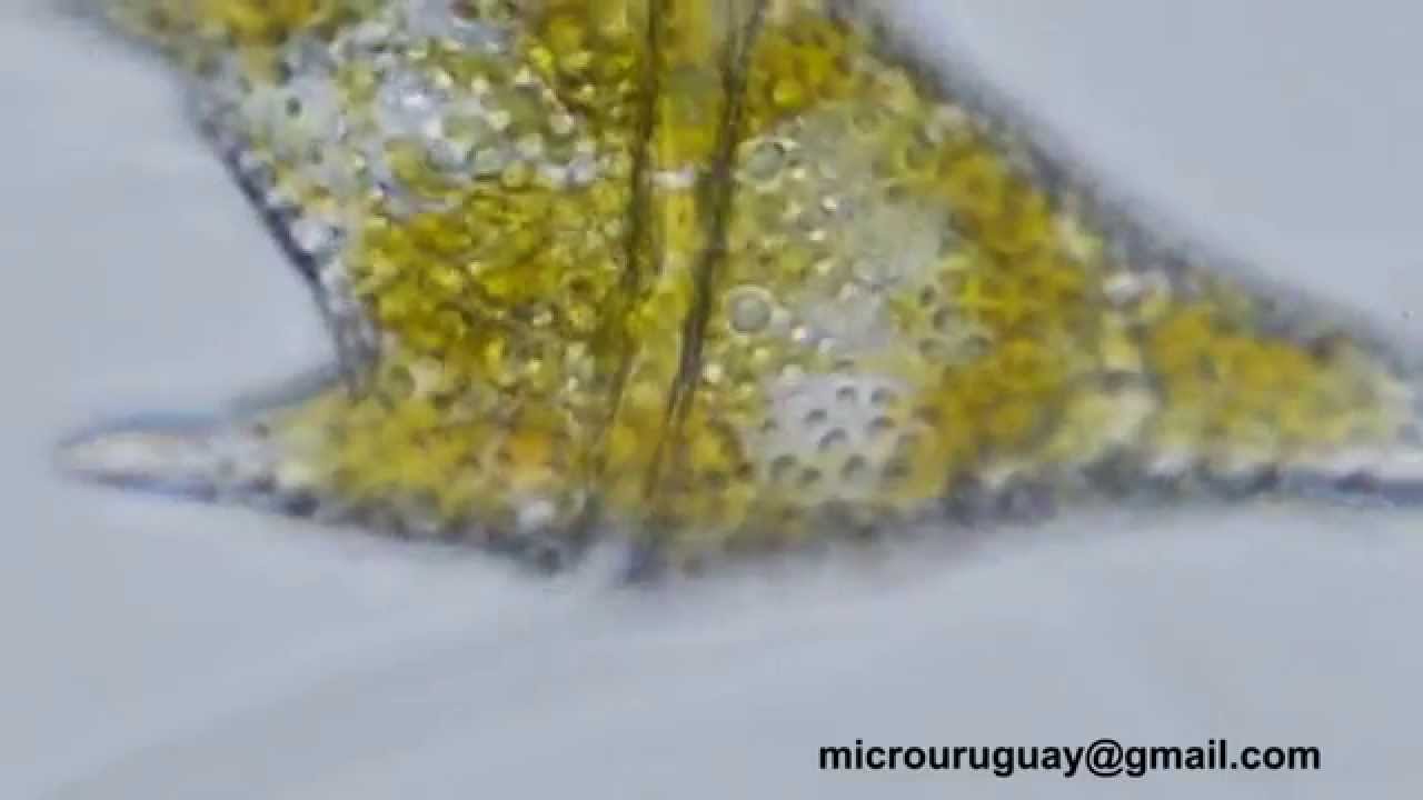 Ceratium Under Microscope