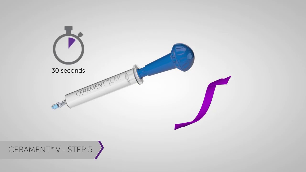 CERAMENT® V second generation mixing instructions - YouTube