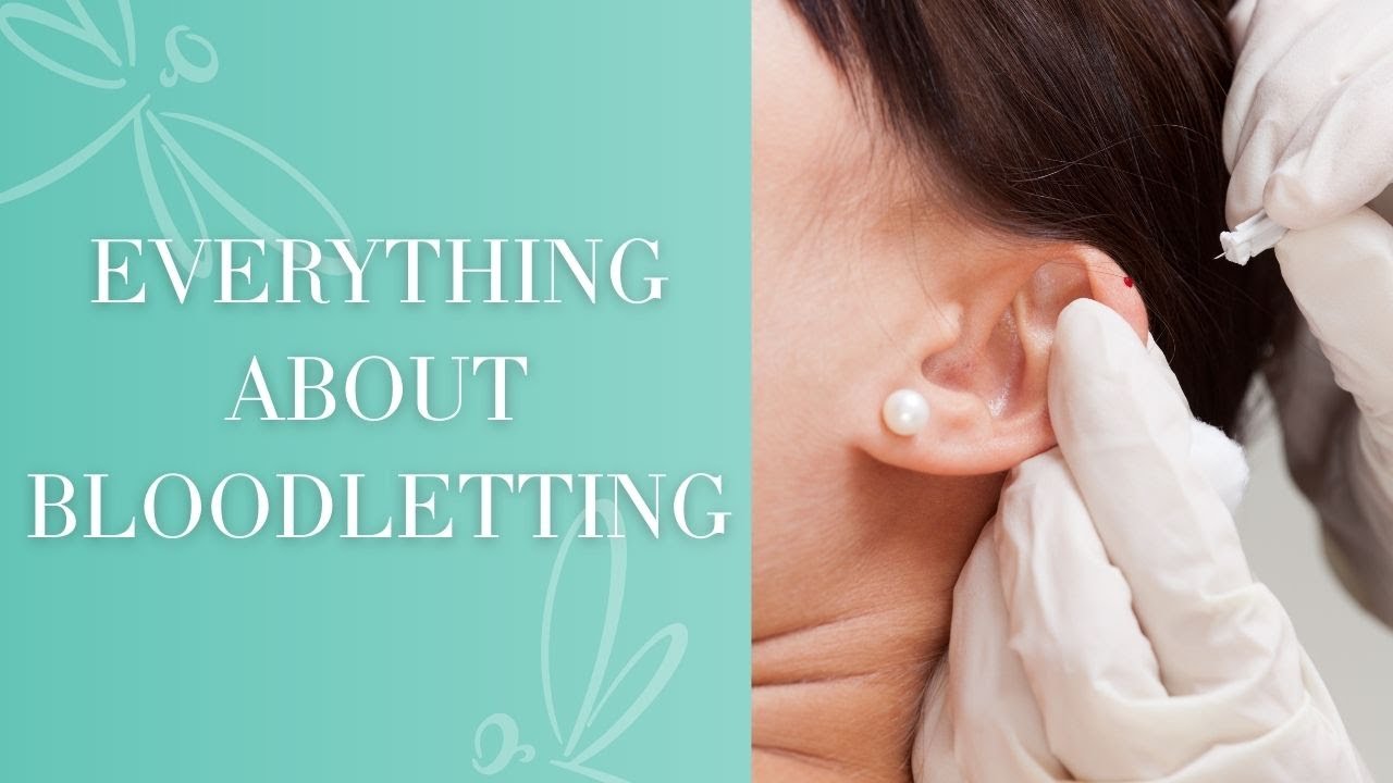 What is Bloodletting: TCM Solutions for Acute Inflammation ...