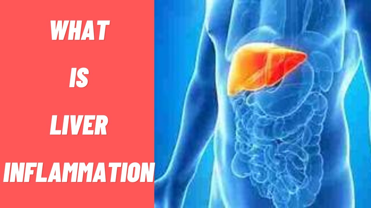 What Is Liver Inflammation - YouTube