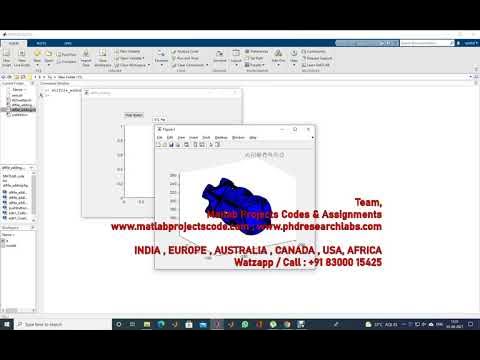 How to import stl file to matlab ? | www.matlabprojectscode.com | www ...