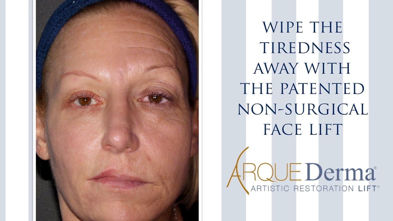 Watch how the morphing of this patient's face reveals a more rested ...