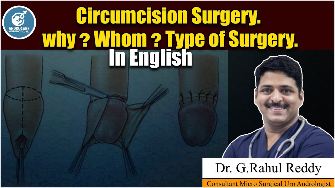 Full Details Of Circumcision Surgery || Dr Rahul Reddy || Androcare Andrology Institute - YouTube