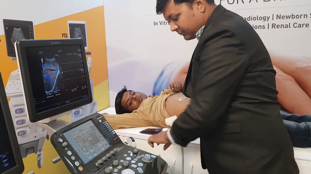 Asif Mohammad Ultrasound, Dual Gate Doppler Exploration - YouTube