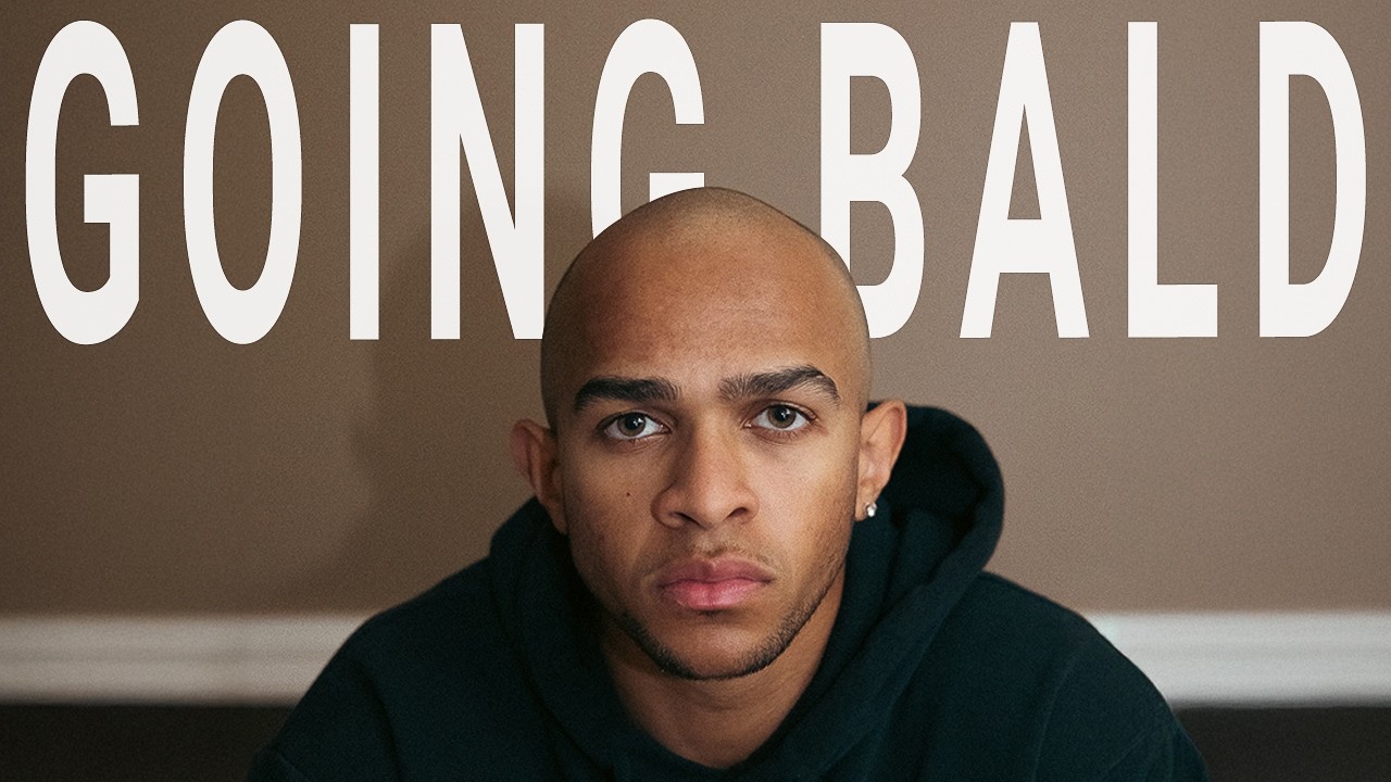Im 23 and i'm going bald. - YouTube