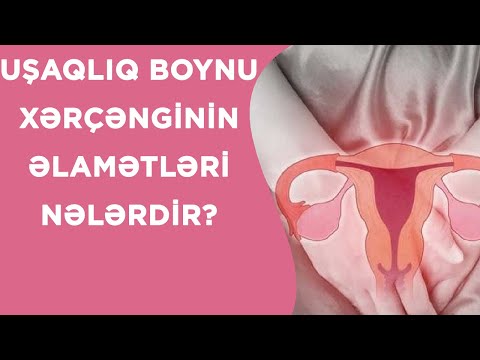 UŞAQLIQ BOYNU XƏRÇƏNGİNİN ƏLAMƏTLƏRİ NƏLƏRDİR❓