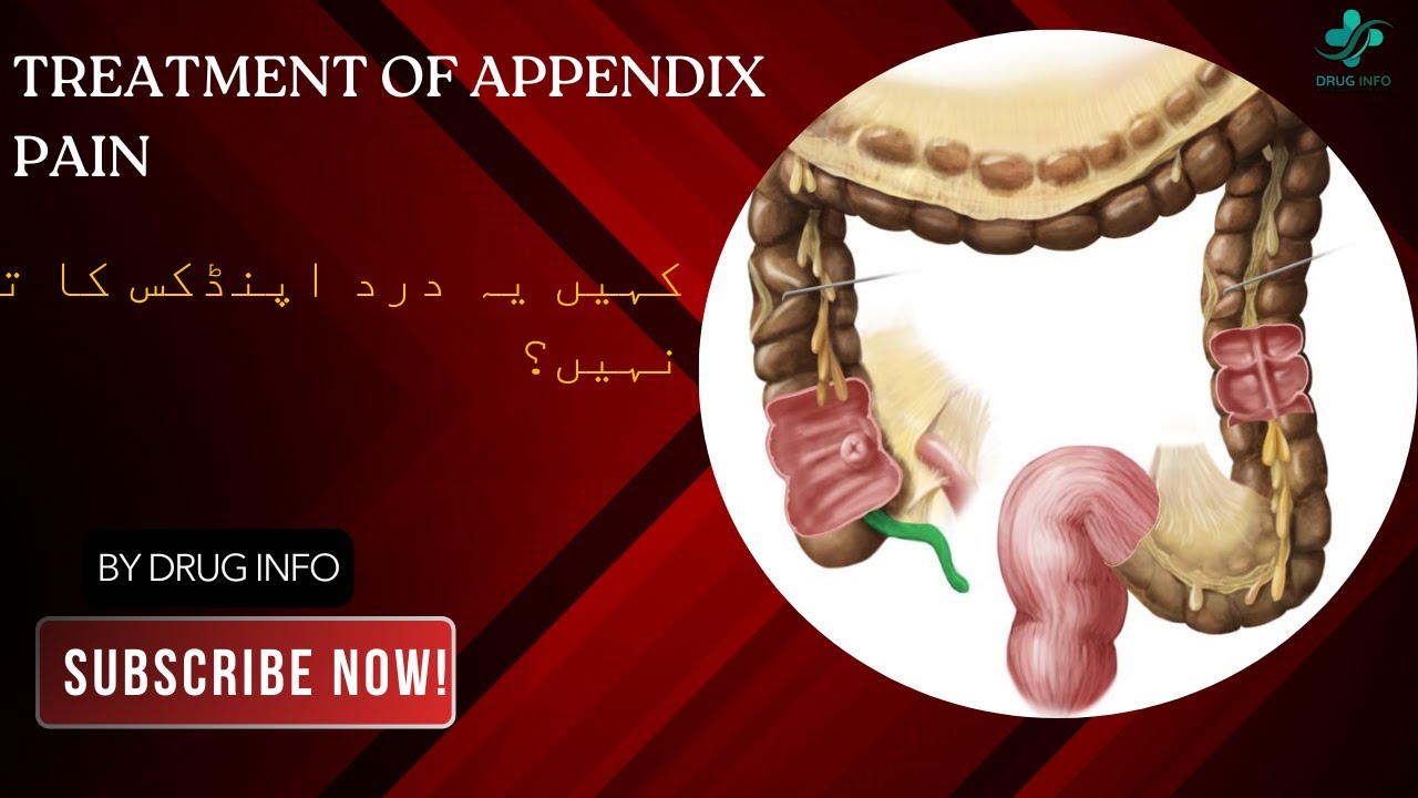 Treatment of Appendix pain | اپینڈکس کے درد کا علاج By @Drug-Info - YouTube