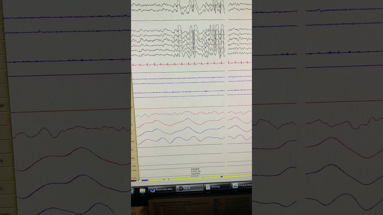 Sleep study recording - YouTube