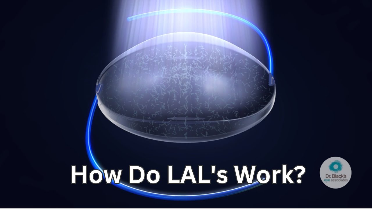 How does the Light Adjustable Lens™ (LAL) Work? - YouTube