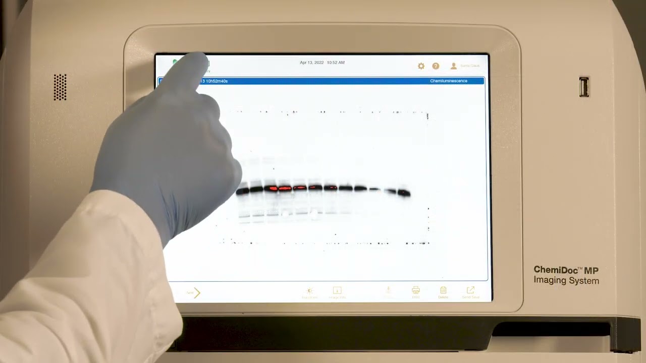 Quick Tips: Signal Accumulation Mode on a ChemiDoc Imaging System for ...