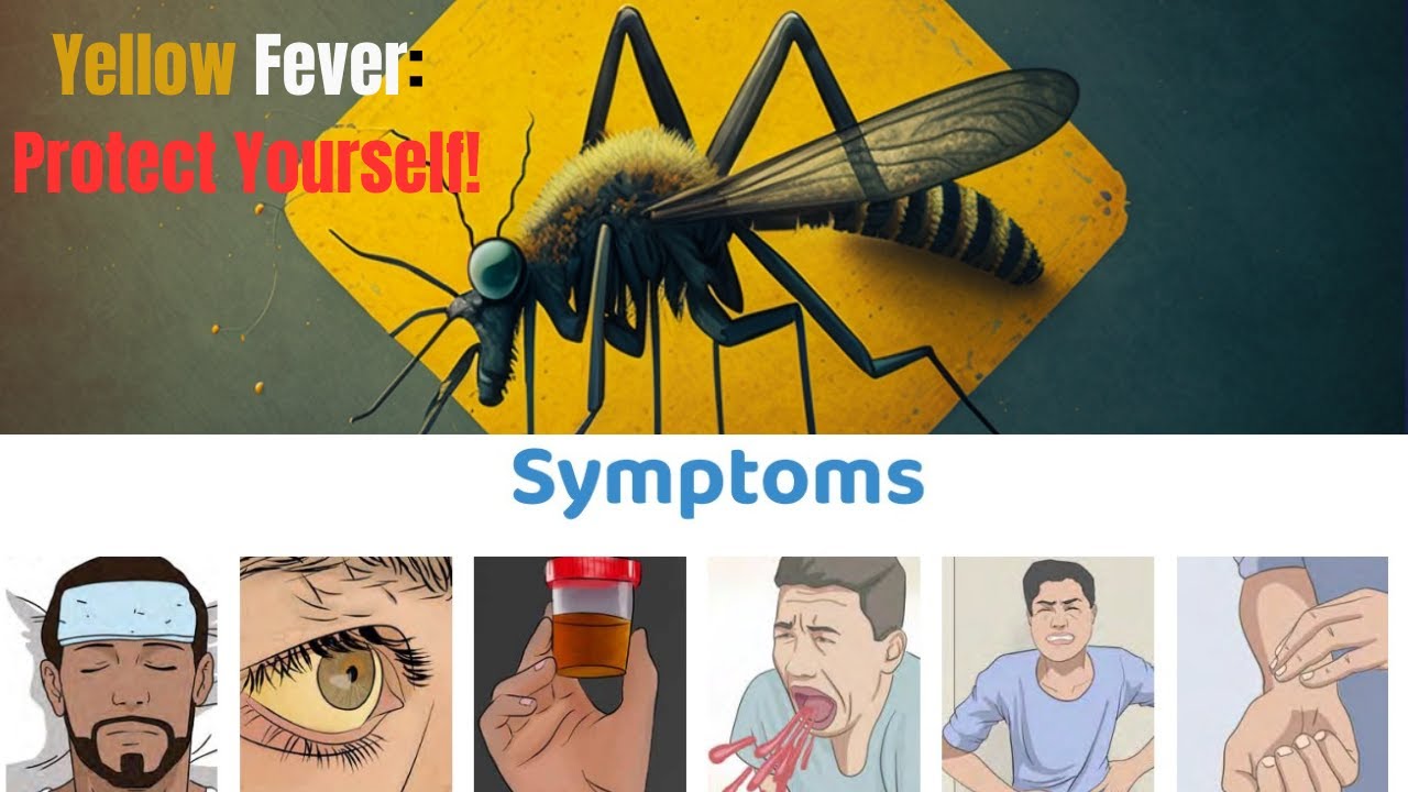 Yellow Fever Explained: Symptoms, Prevention & Everything You Need to ...