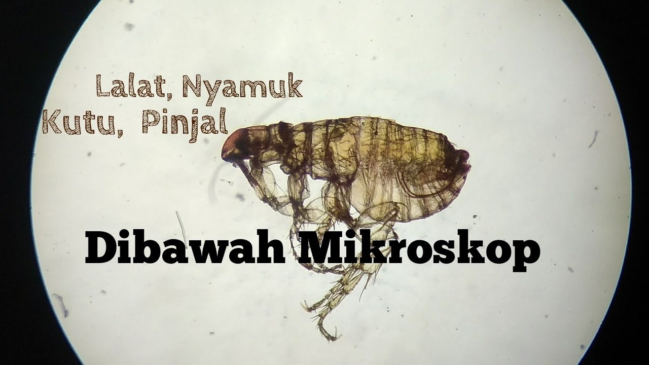 Gambaran Dibawah Mikroskop (Lalat, Kutu, Nyamuk dan Pinjal) || Parasit ...