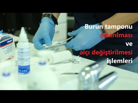Burun tamponu çıkarılması alçı değişimi - Op. Dr. Orhan Murat Özdemir