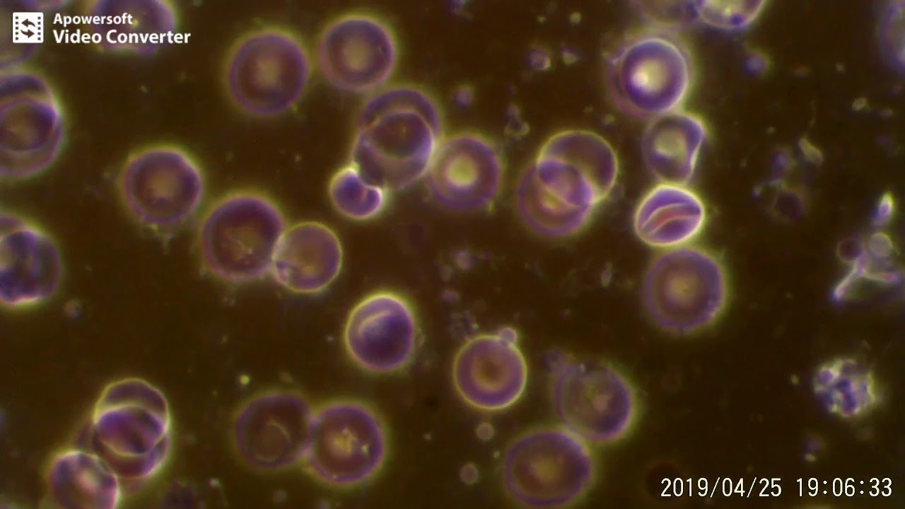 fresh blood 01 - YouTube