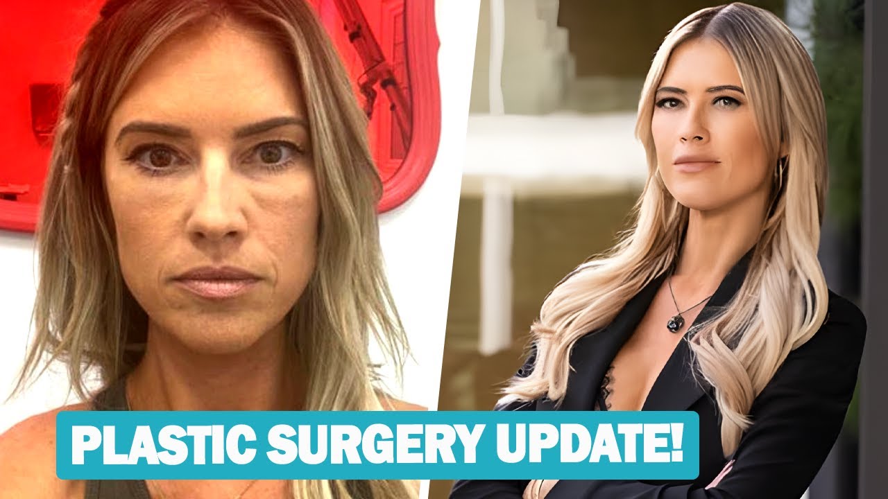Christina Haack Reveals Teffifying Update About Plastic Surgery #hgtv ...