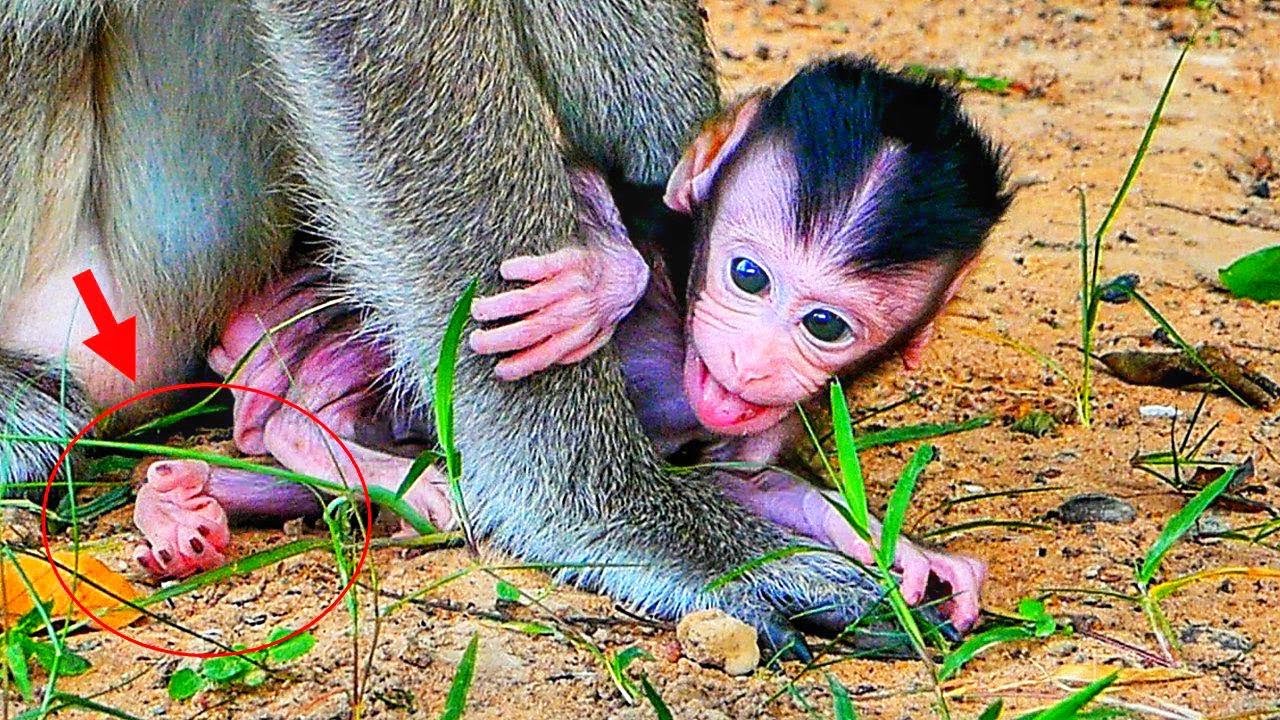 Omg.!! Cute Newborn Poor Health, Baby's Weak Leg and Less Walking ...