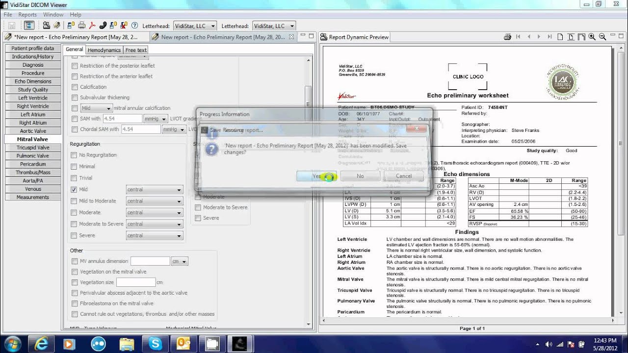 Report viewer and template building - YouTube
