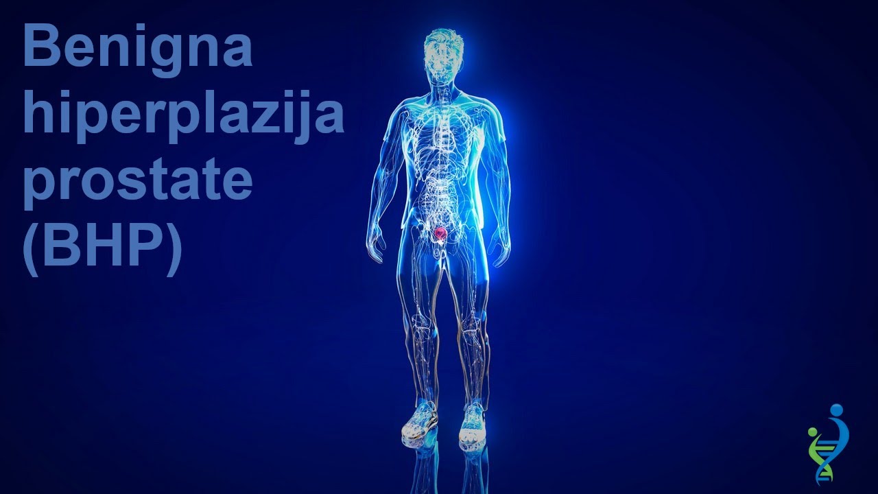 Benigna hiperplazija prostate - YouTube