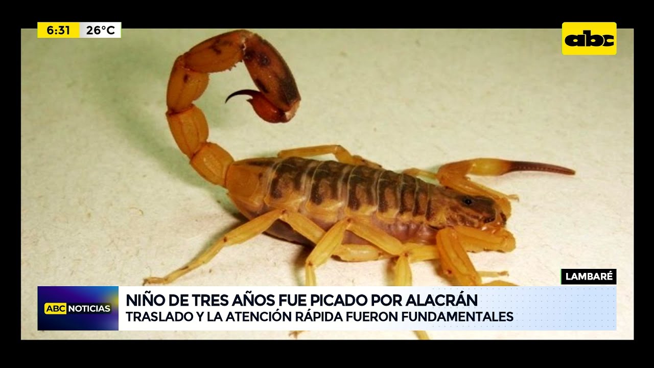 Niño de tres años fue picado por alacrán amarillo en Lambaré - YouTube